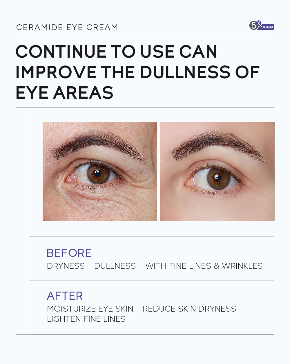 2x Hyaluronic Acid Repair Fine Lines Eye Bag Eye Moisturizer 15g Quiyum ...