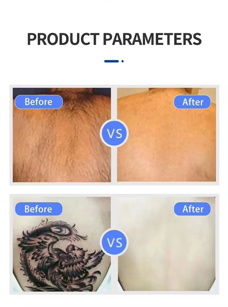 skin cooling device - vivalaser for you for all for beauty