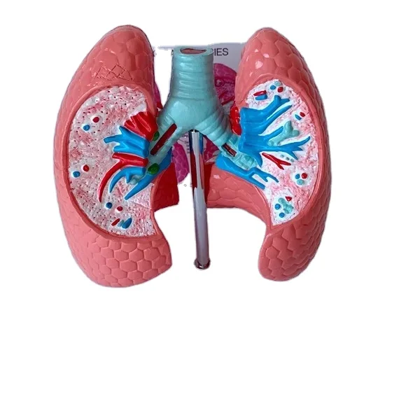 Pathological And Healthy Lung Anatomical Model - Buy Pulmonary Disease ...