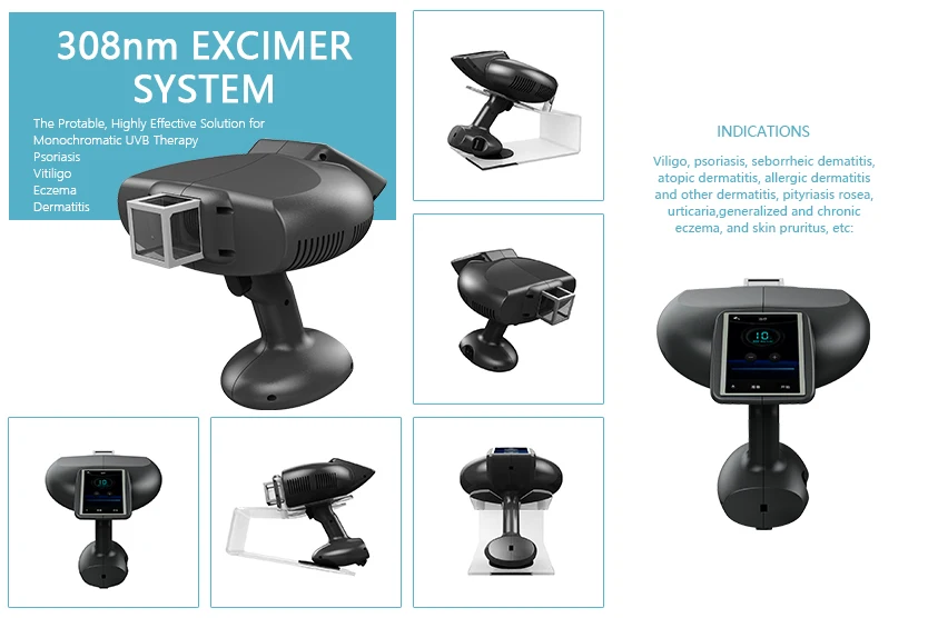 308nm Excimer Laser Vitiligo Psoriasis Ultraviolet System Hospital ...
