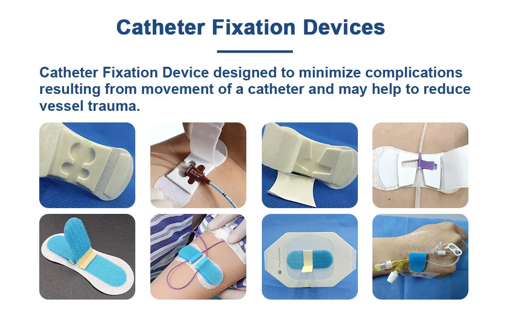Picc/cvc Medical Catheter Securement Device By Attaching On Skin For ...