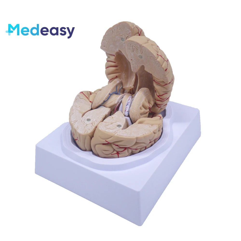 Brain Model, Brain Anatomy Model, Brainstem Model, Brain Structure ...