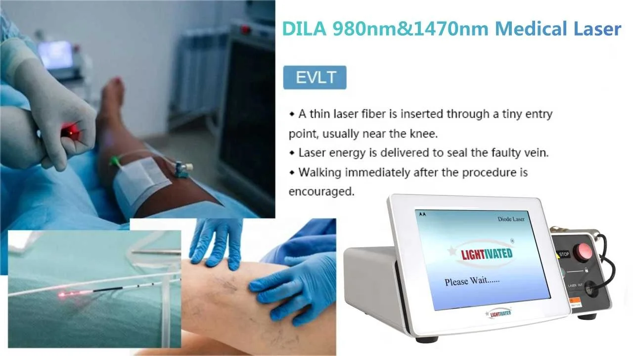 1470nm Diode Laser EVLT Endovenous Liposuction Machine Facial Leg ...