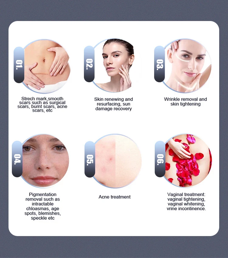 Portable Co2 Laser Fractional Laser Scars Removal Acne Treatment Marks ...