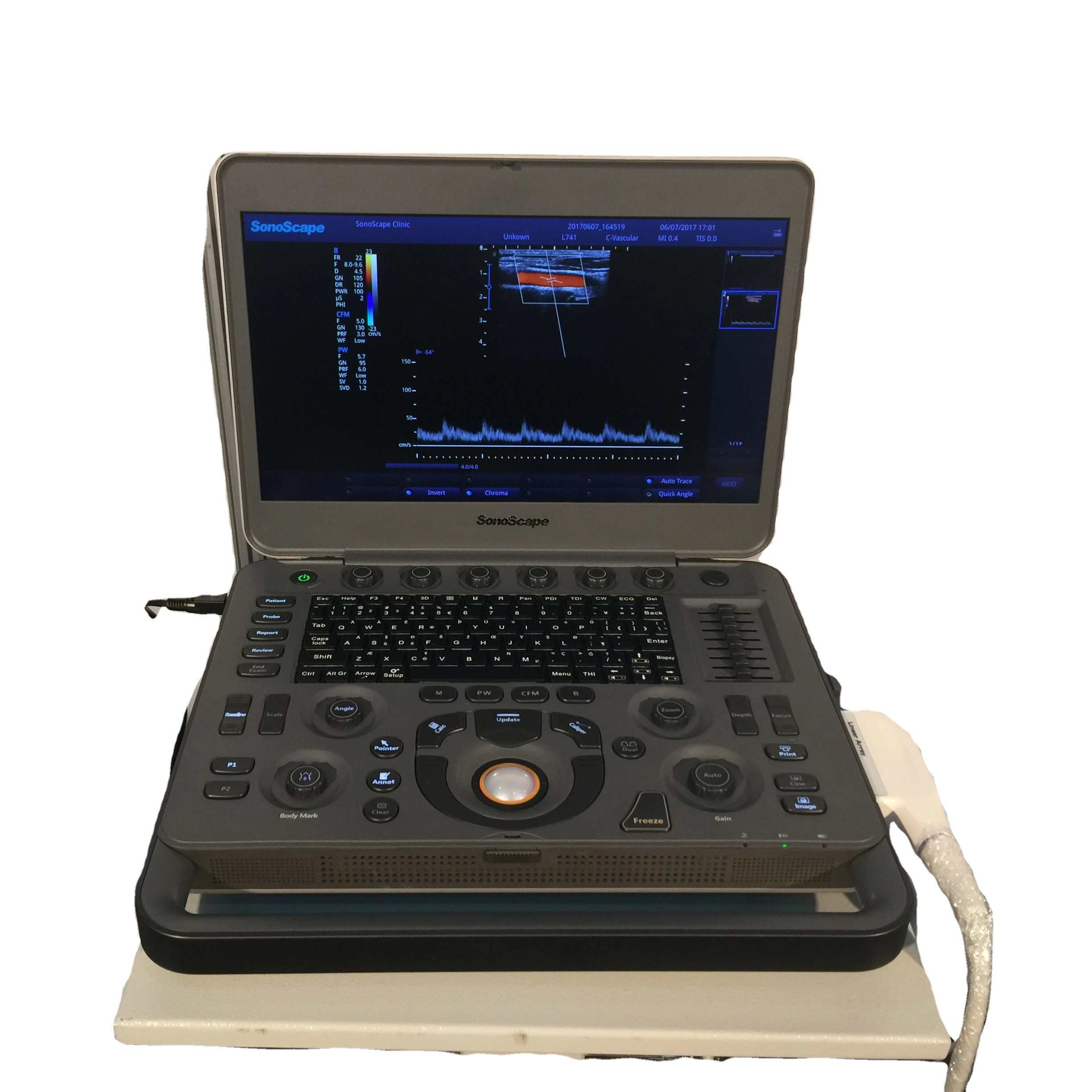 便携式sonoscape超声检查，多普勒功能sonoscape超声x3便携式扫描仪 - Buy Sonoscape X3便携式扫描仪,多普勒 ...