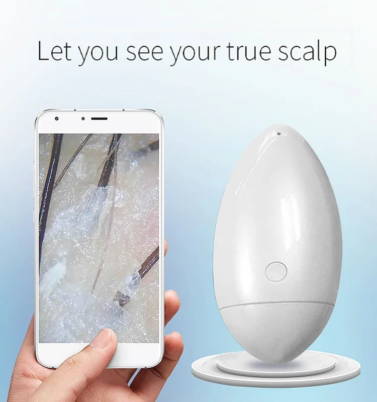 Wireless Scalp Scanner Camera 500X HD Hair Follicle Analyzer