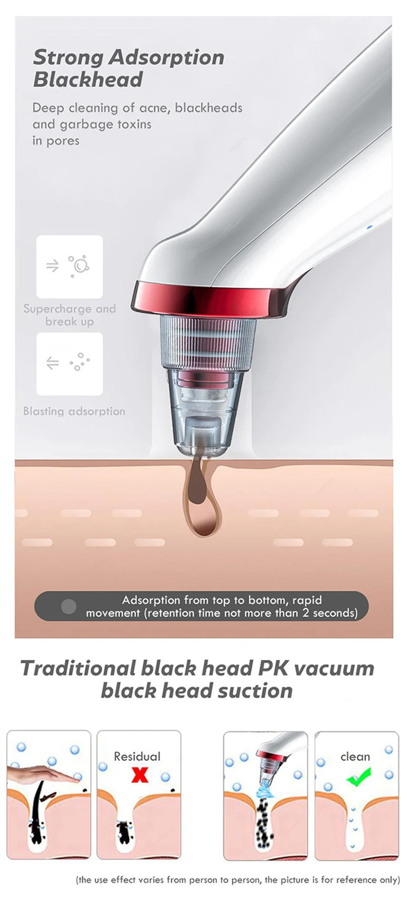 MEIXU Pimple Removal Machine - Efficient Blackhead Remover