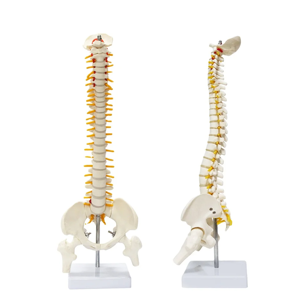 Anatomical Skeleton Human Lumbar Disc Herniation Model Demonstration ...