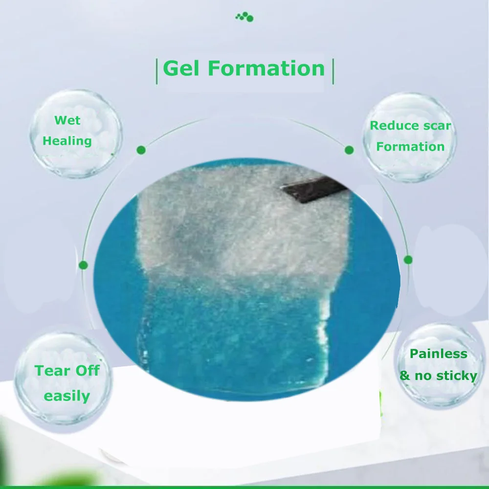 Alginate Wound Dressing - Advanced Wet Healing Solutions