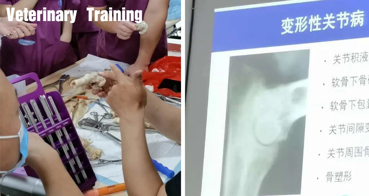 Chinese Cmf Calcaneal Plate Titanium Plate - Buy Trauma Plate And Screw ...