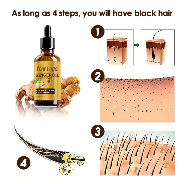 Oem Ginger Hair Growth Serum Natural Organic Custom Hair Care Hair Loss ...
