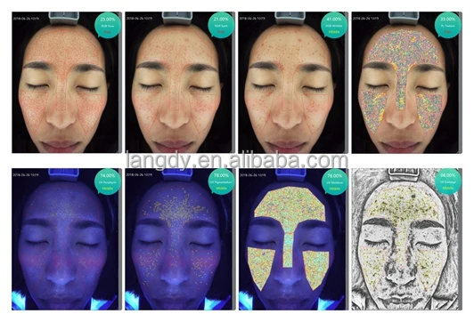 2021 Portable Skin Analyzer Face Beauty Equipment Facial Equipment Skin ...