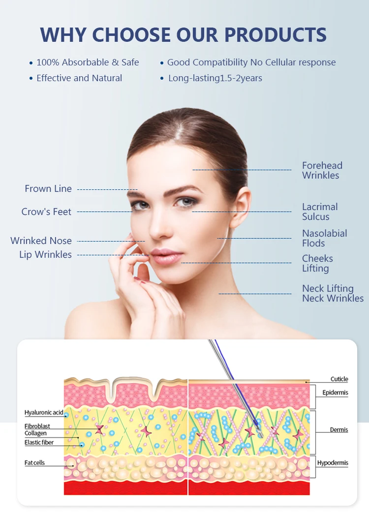 Face Lift Threading Pdo Lifting Thread With Good Quality Mono (sharp ...