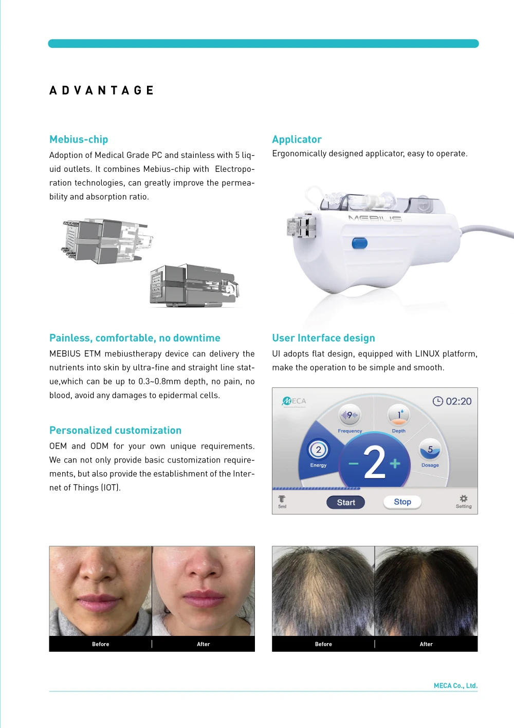 Micro Needle Painless Mesoderm Therapy Instrument Skin Rejuvenation ...