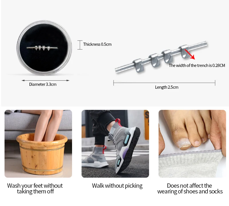 Ingrown Nail Hooktoenail Corrector Orthotic Nail Fixer Toenail ...