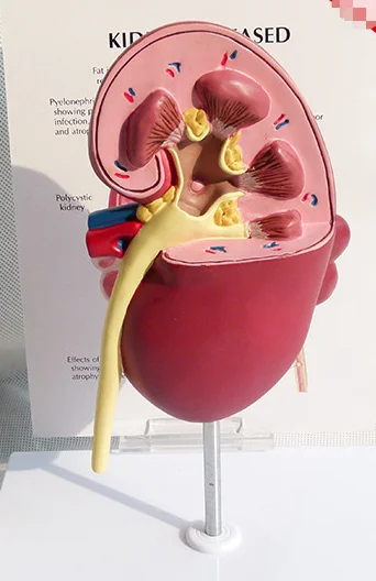 Medical Anatomy Pathological Research Models High-quality Kidney ...