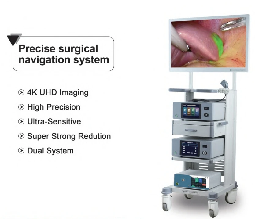 Endoscopy Camera System - 4K Medical Laparoscopic Rigid Endoscope