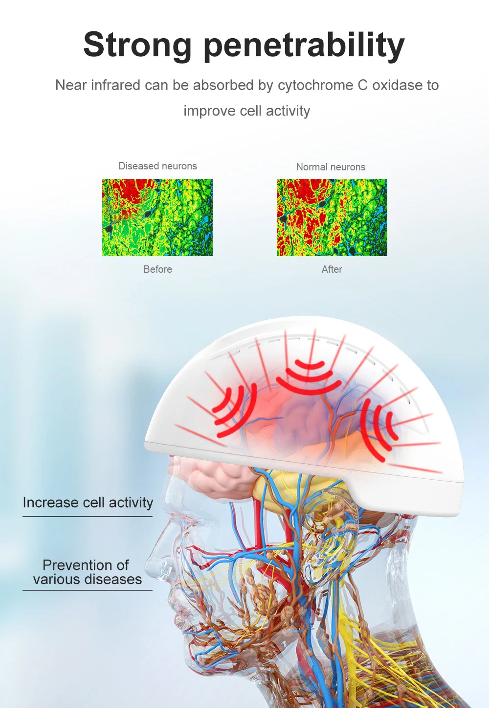 Suyzeko Brain Health Care Device 810nm Near Infrared Physical Therapy ...