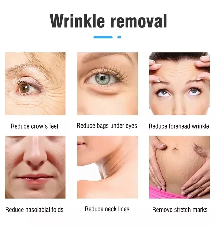 Hi-fu+vmax Machine Skin Lifting Body Sculpting Fat Dissolving Skin ...