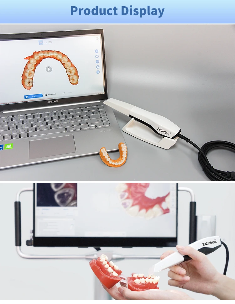 Factory Prices Dental Clinic Intraoral Scanner Full Medical 3d Digital ...