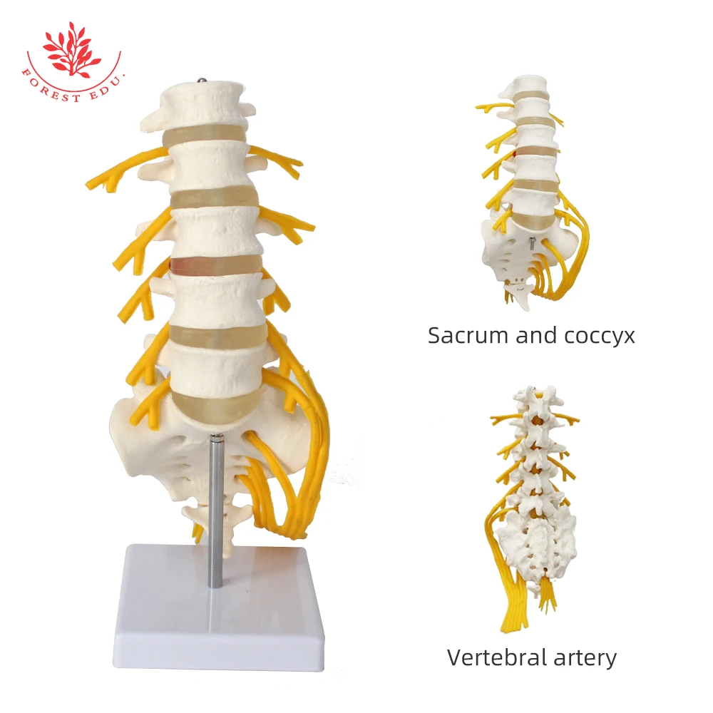 Lumbar Vertebrae Spine Anatomical Model High Quality Disc Herniation ...