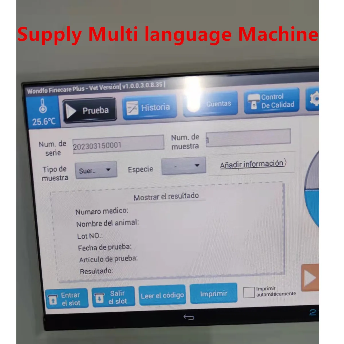 Wondfo FIA Meter - High Accuracy Progesterone Test Machine