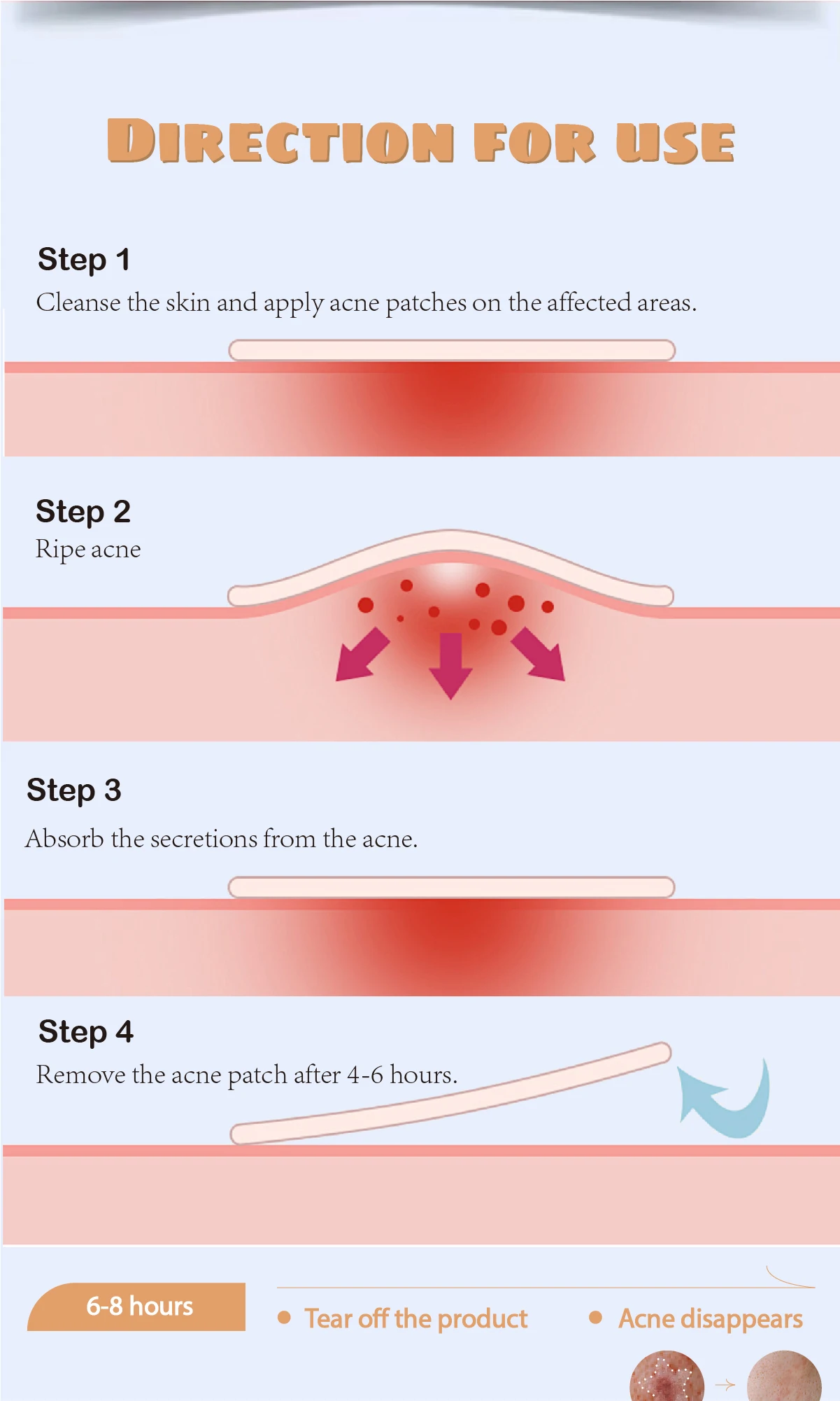 Custom Acne Patch - Hydrocolloid Treatment for All Skin