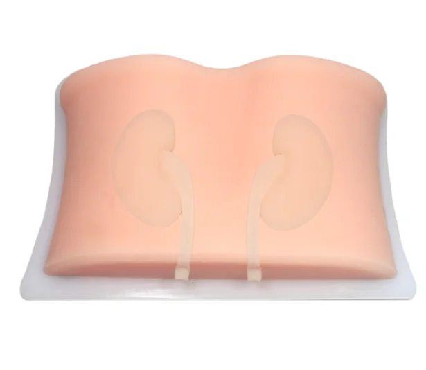 Medical Science Kidney Puncture Model Guided by Ultrasound for Training ...
