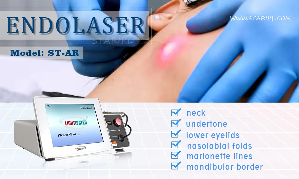 Alibaba.com: Vaser Lipo Endolazer Diode Laser 980nm 1470nm for fat ...