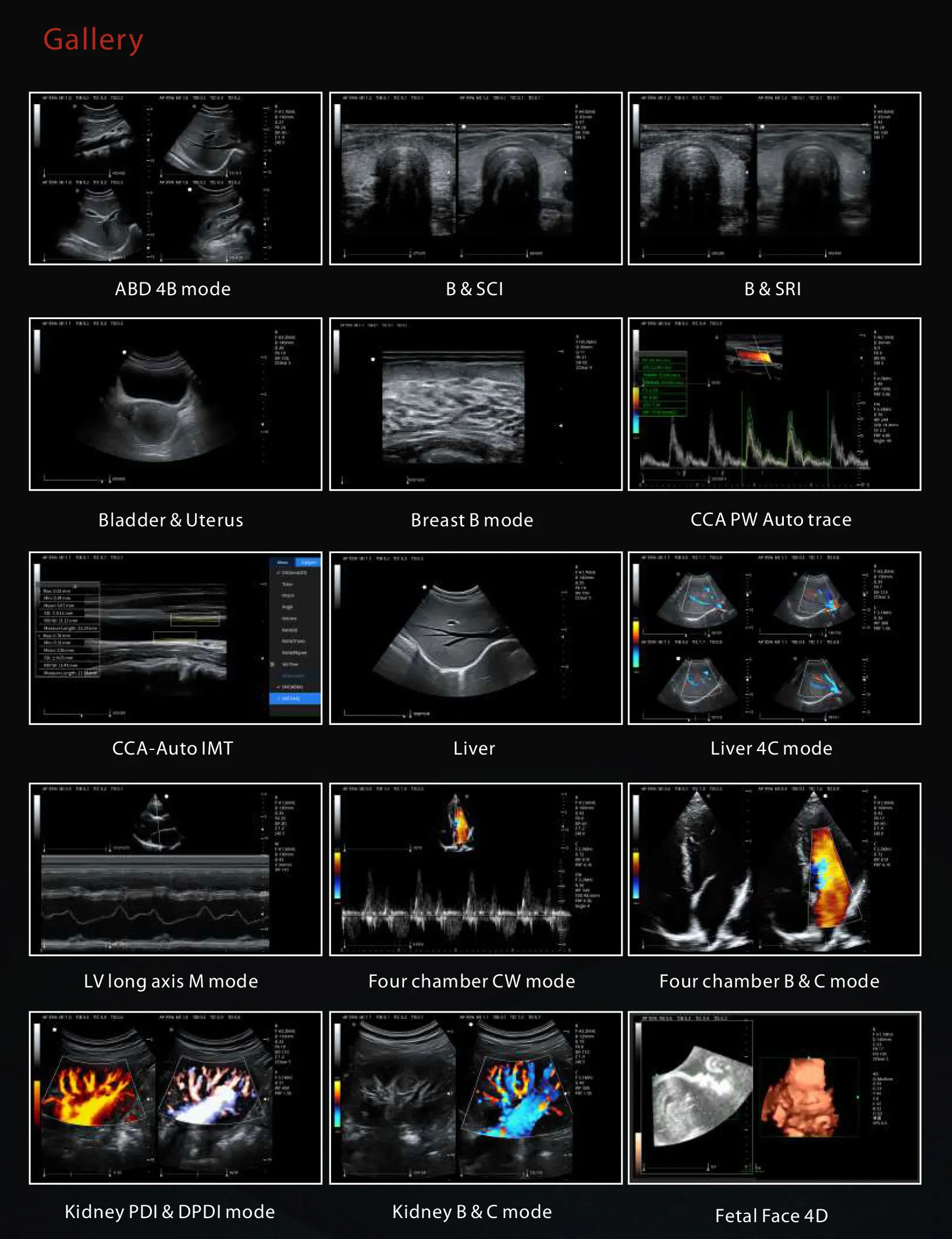 MSL Color Doppler 4D Ultrasound - Superior Imaging Quality