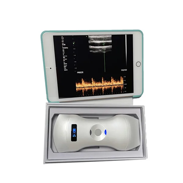 192 Elements Convex Linear Phased Array Color Doppler Ultrasound ...