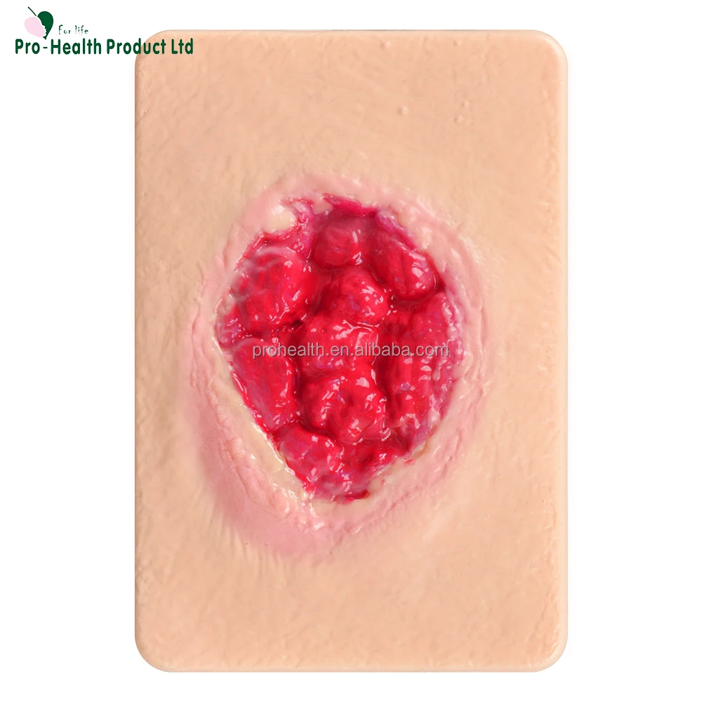 Chronic Granulation Tissue Model Simulator 4 Types of Granulation ...