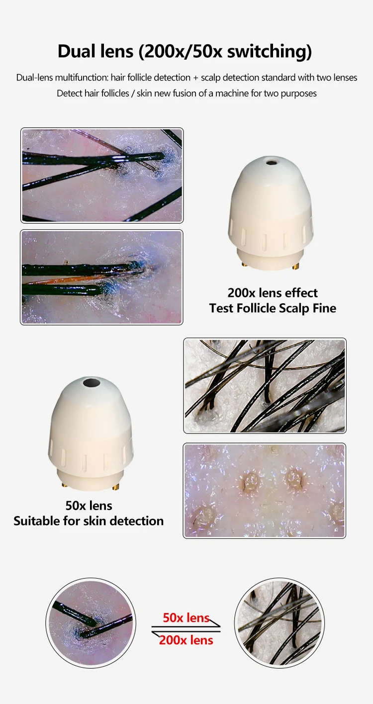 Scalp Scanner - Professional Hair and Skin Analyzer