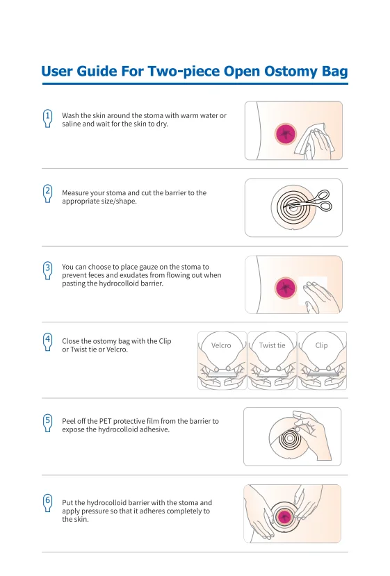 Colostomy Bag Ostomy Bag With Transparent Non-woven Fabric Outer Lining ...