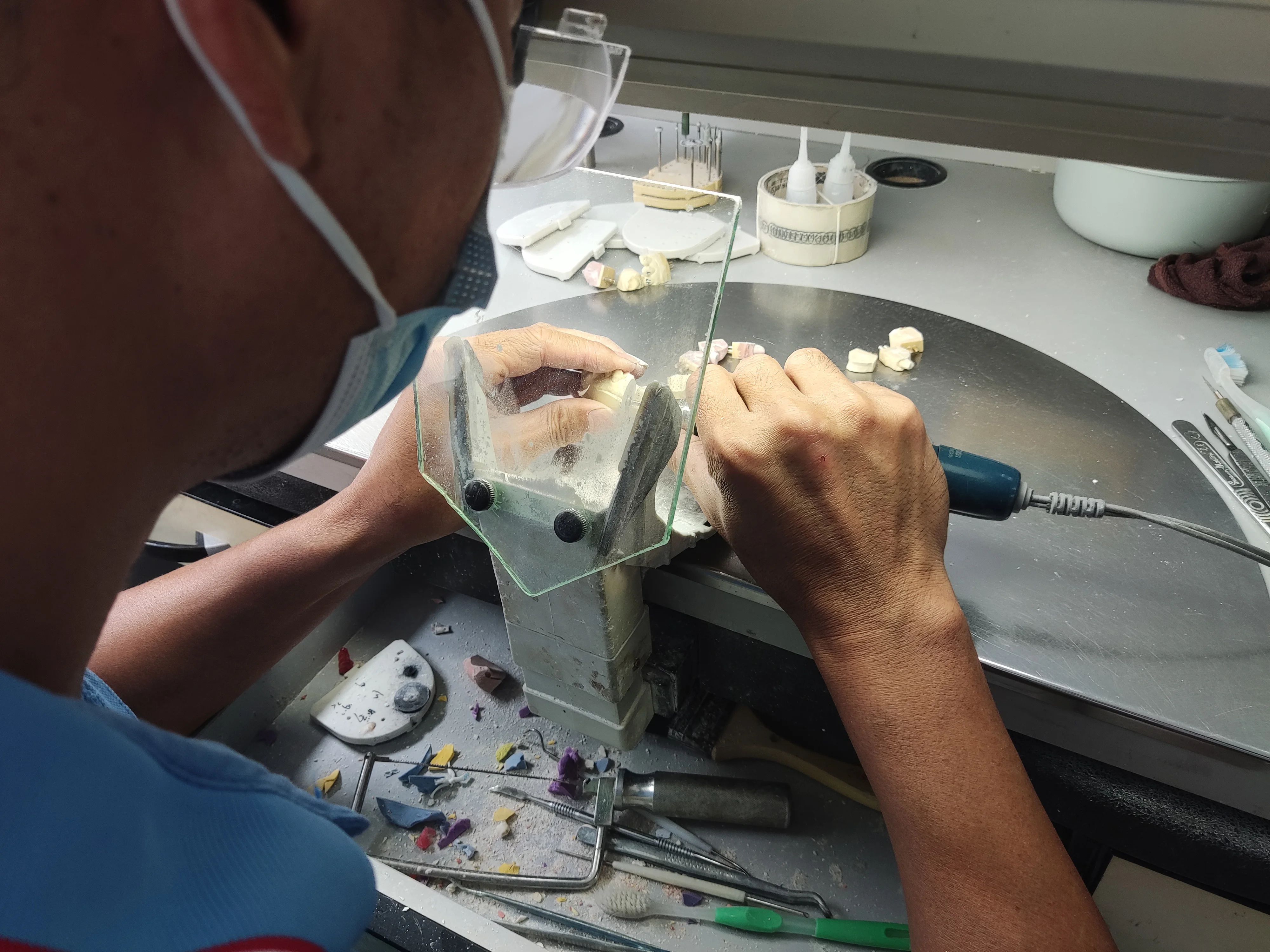 Ceramic Porcelain Emax Dental Veneers Crown and Bridge Pfm Denture with ...