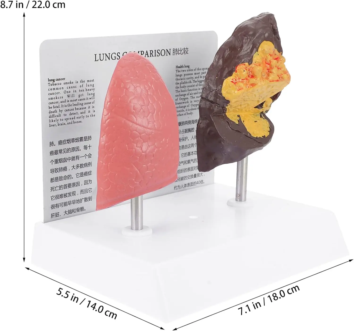 Medical Sciences Lung Contrast Model Health And Pathology Laboratory ...
