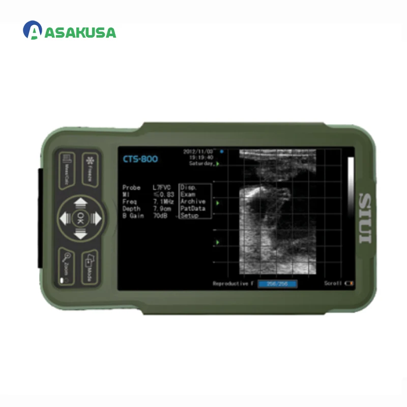 Asakusa & Siui Cts-800 Vet Palm-sized Portable Veterinary Color Doppler ...