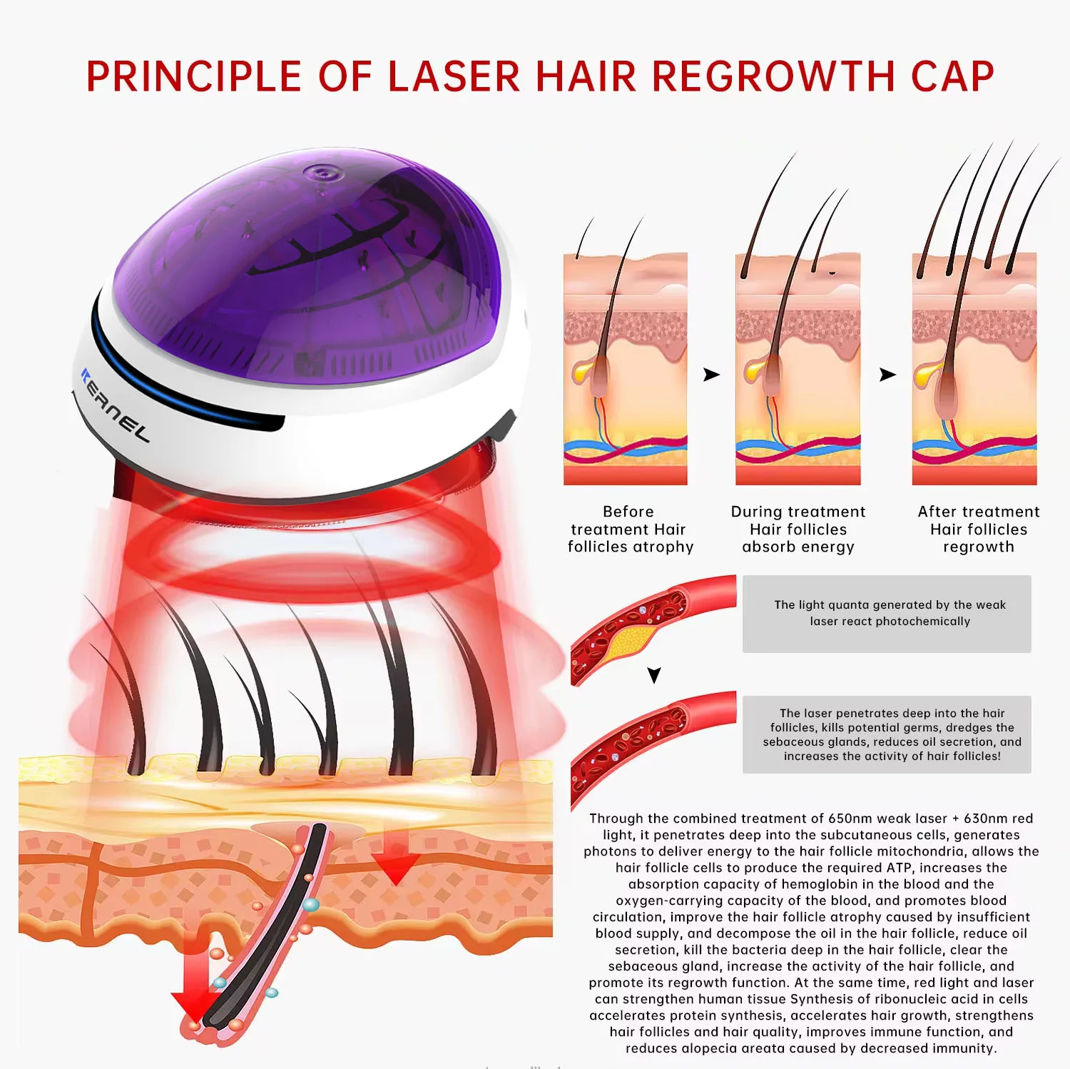 204 Diode LLLT Laser Hair Growth Helmet for Fast Regrowth