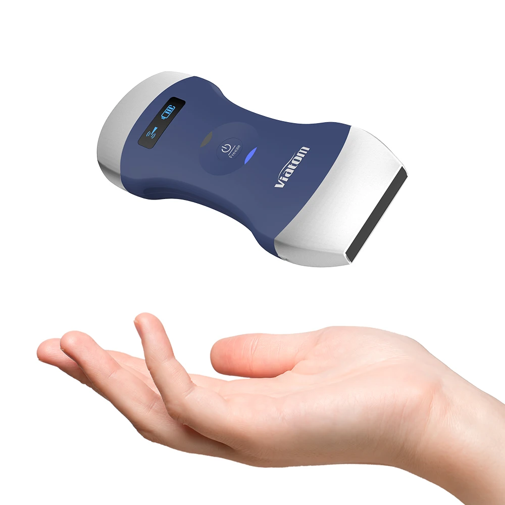 Viatom Dual Head Ultrasound Scanner - Portable & Wireless