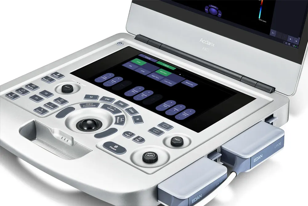 Edan Acclarix Ax3 Ultrasound Machine for Obstetrics & Gynecology