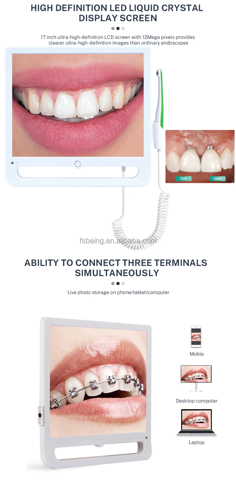 Being New Dental Intraoral Camera Sleeve Photography Oral Endoscope ...