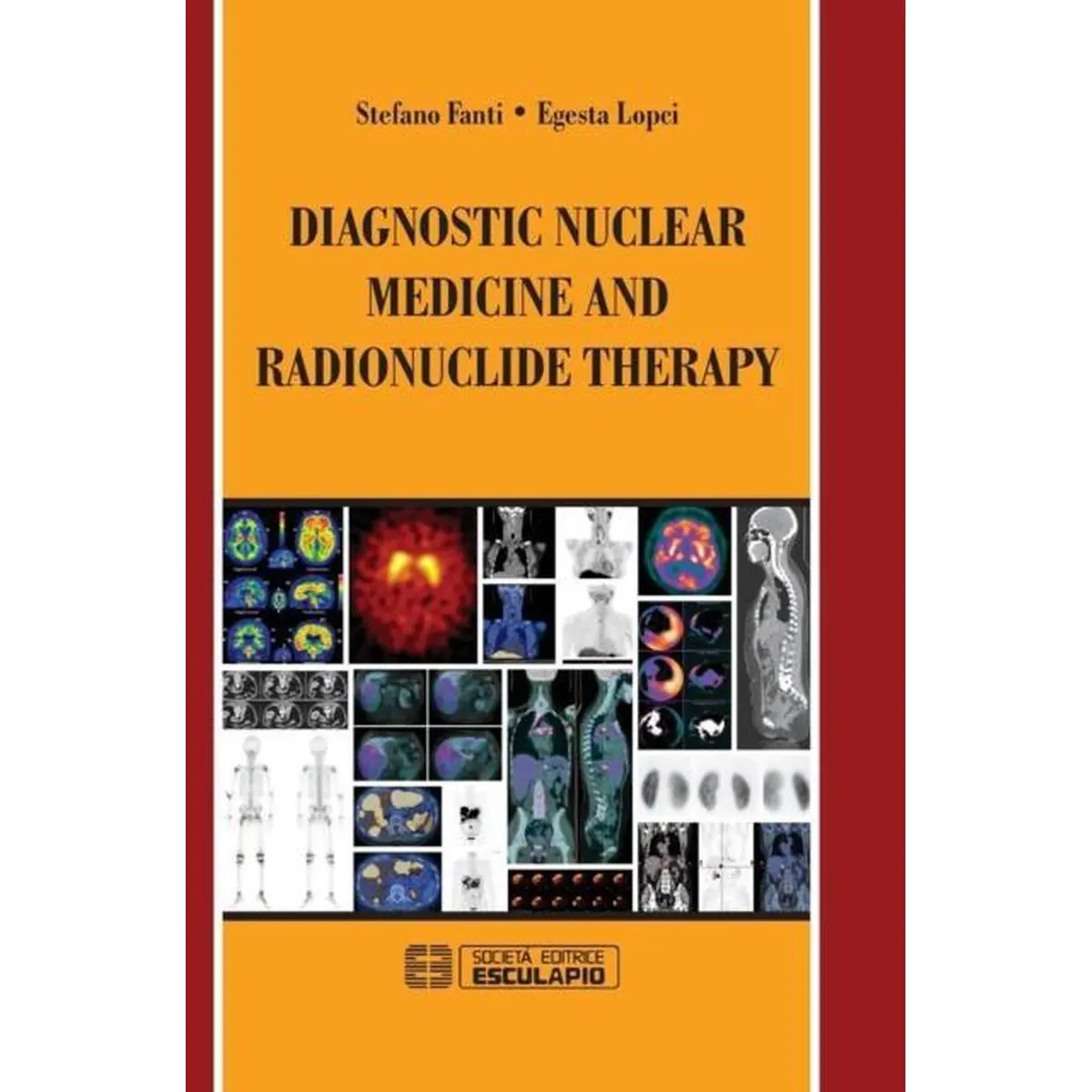 Diagnostic Nuclear Medicine and Radionuclide Therapy 9788874889594 ...