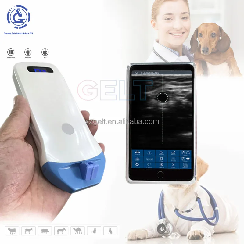 Wifi Color Ultrasound Probe High Frequency 14mhz Linear Probe For Sale ...