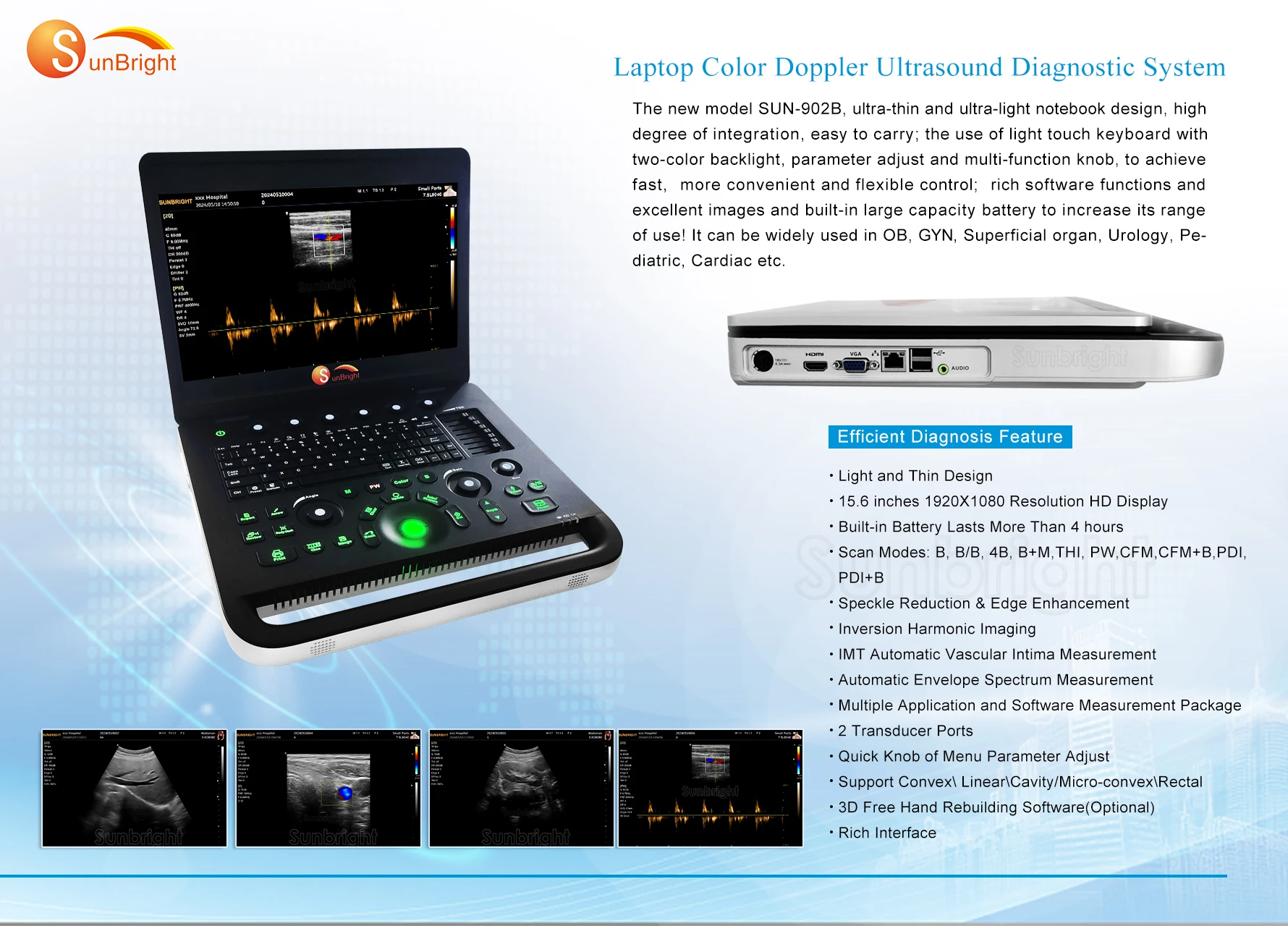 SUN-902B Vet Ultrasound Scanner - Advanced Diagnostic Tools
