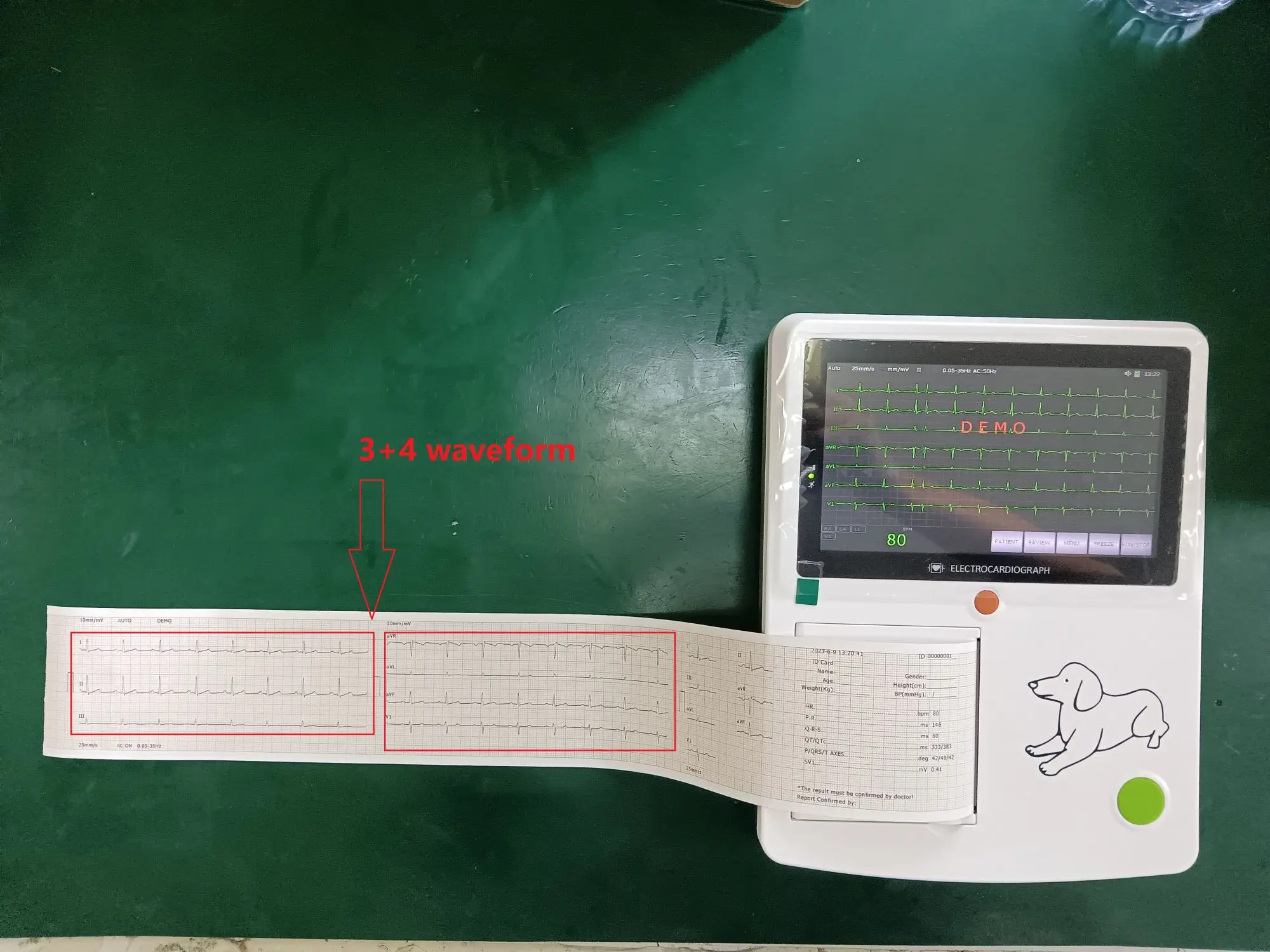 Electrocardiogram Veterinary Instrument 3 Channel Ecg Machine Price For ...