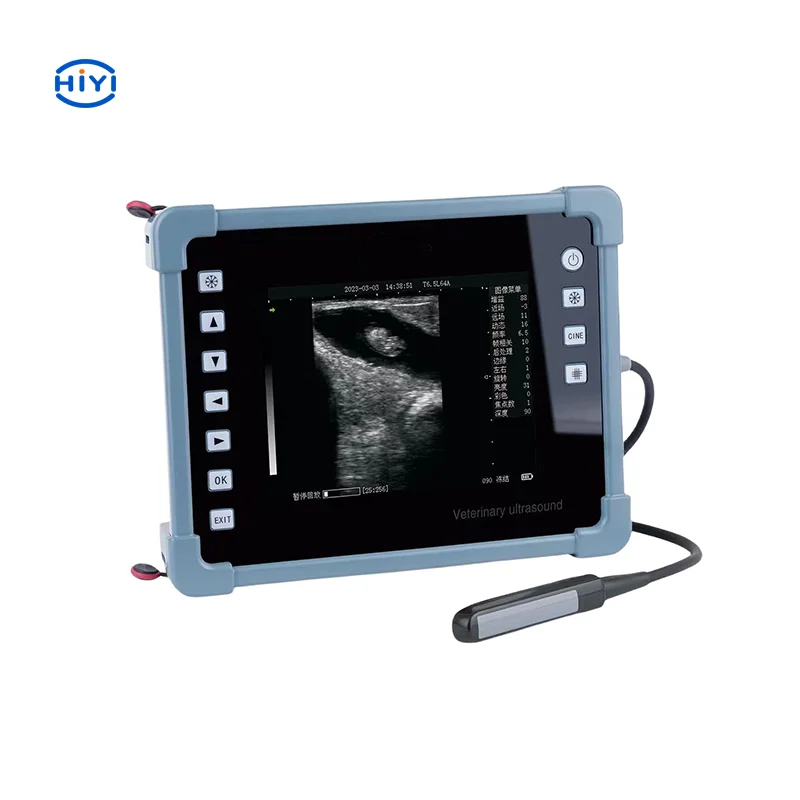 Hiyi Chy8 Professional Digital B-ultrasound Diagnostic Instrument For ...