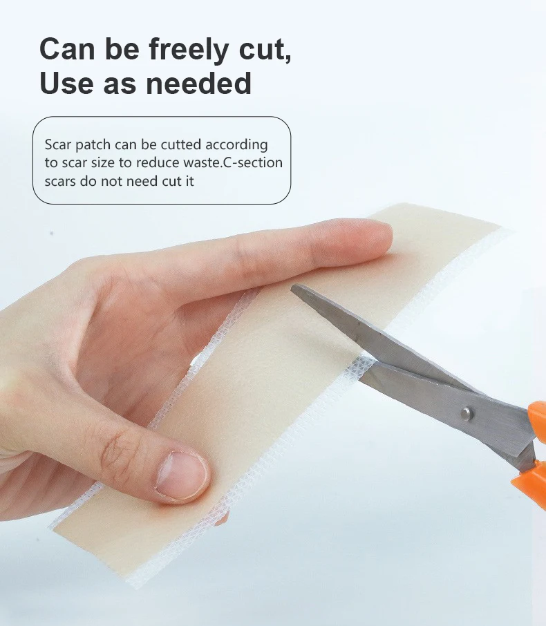 Senwo Breathable Strong Repair Skin Cells Fast Silicone Body Face Scar ...