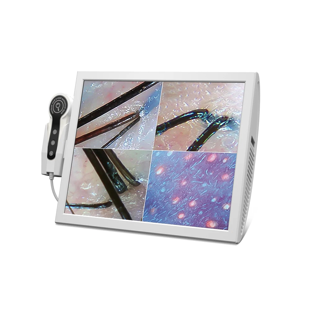 Hair Scalp Scanner Skin and Hair Analyzer with 2 Lens 50X&200X 15 Inch ...