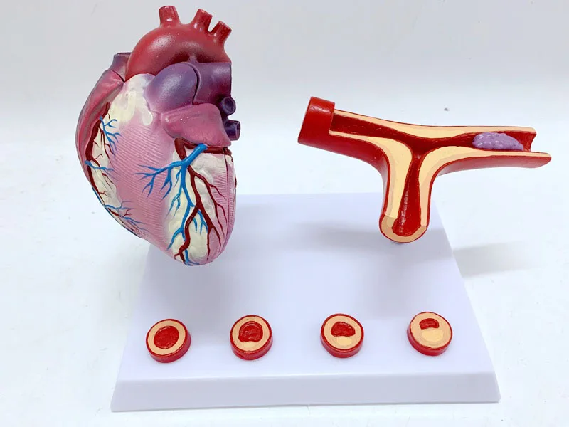 Anatomical Heart Model - Educational Tool for Medical Science