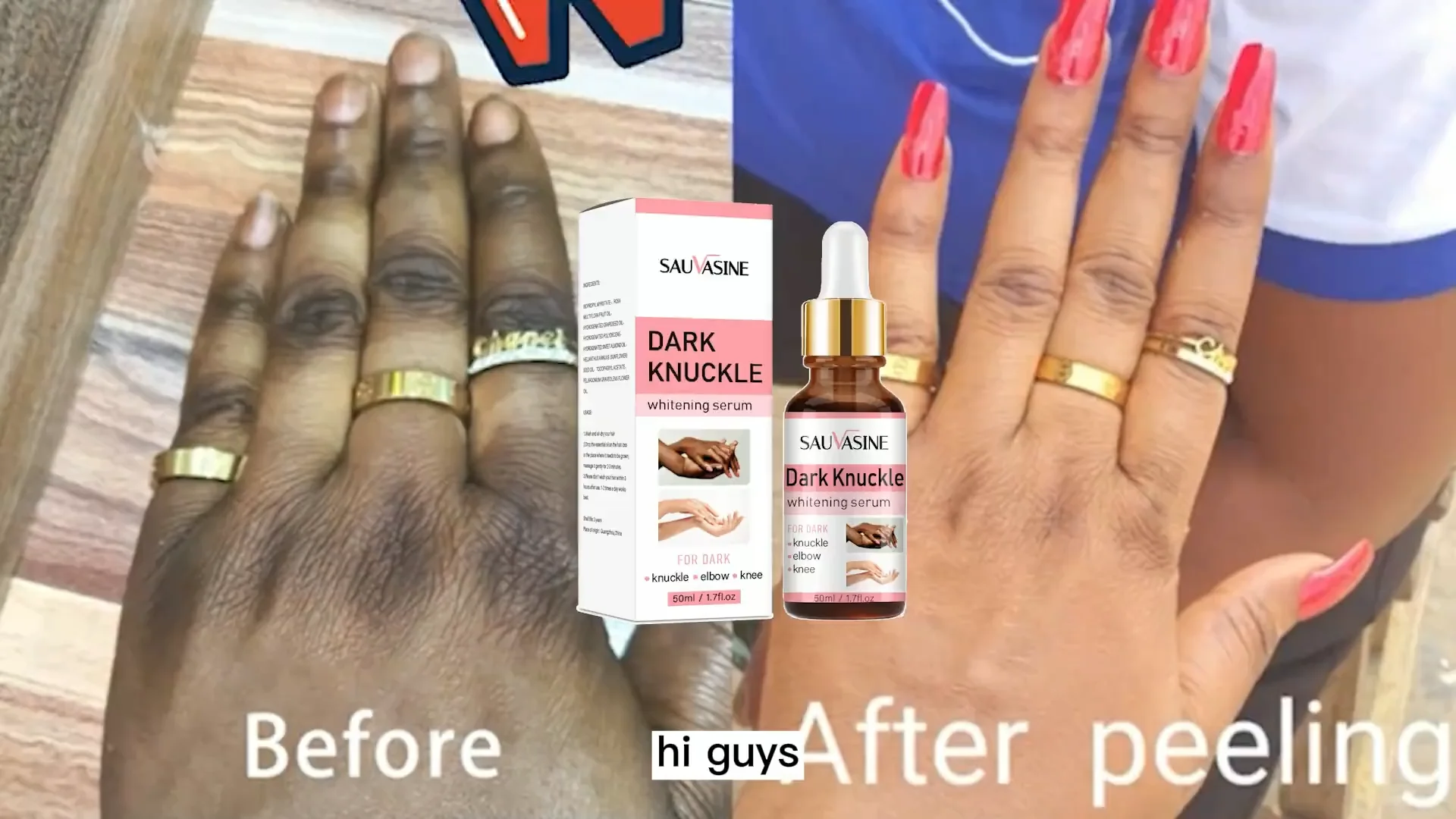 7 Day Dark Knuckles Whitening Pigmentation Serum For Knee Knuckle ...